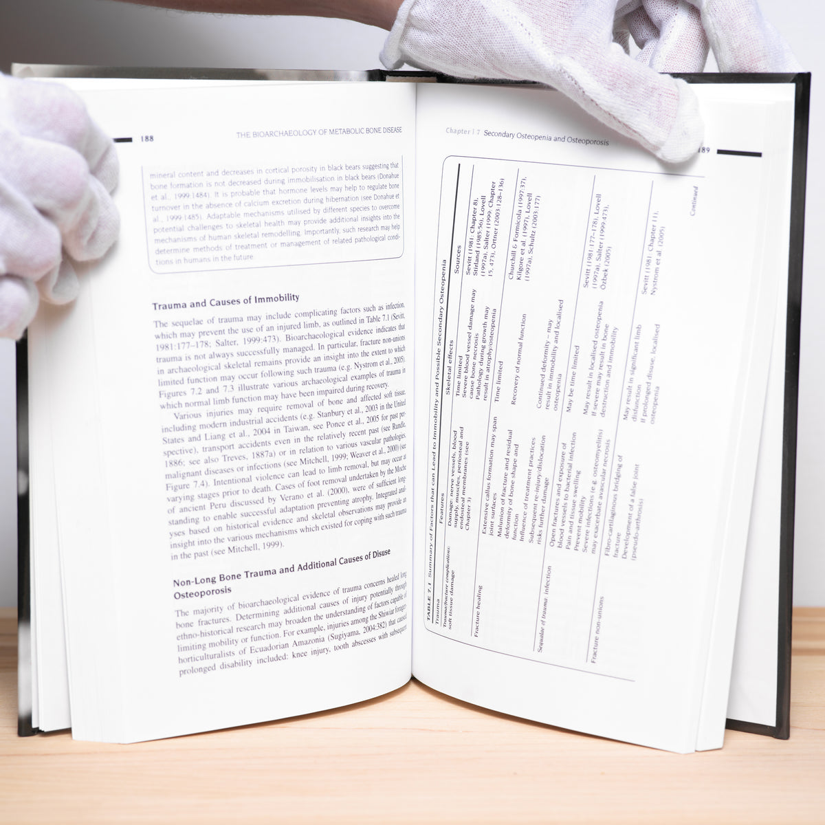 The Bioarchaeology of Metabolic Bone Disease - Brickley, Megan; Ives ...